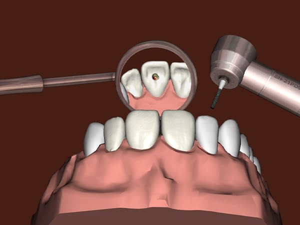 Procedures - Simodont Dental Trainer