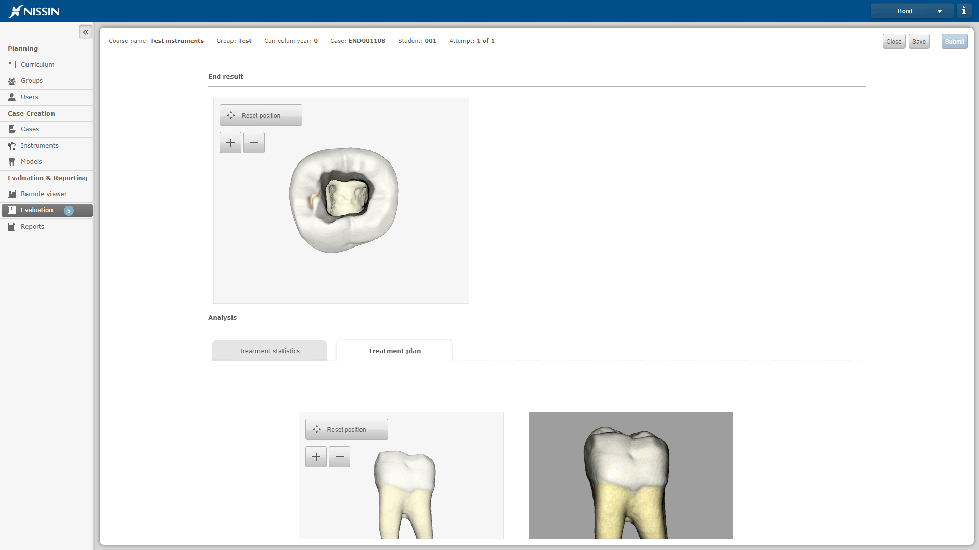 Endodontic preparations - Simodont Dental Trainer - Taking away limits ...