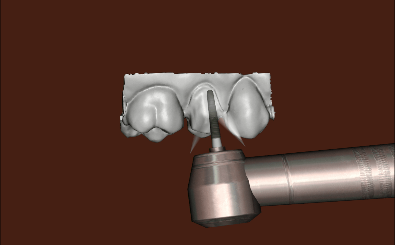 Patient specific - Simodont Dental Trainer